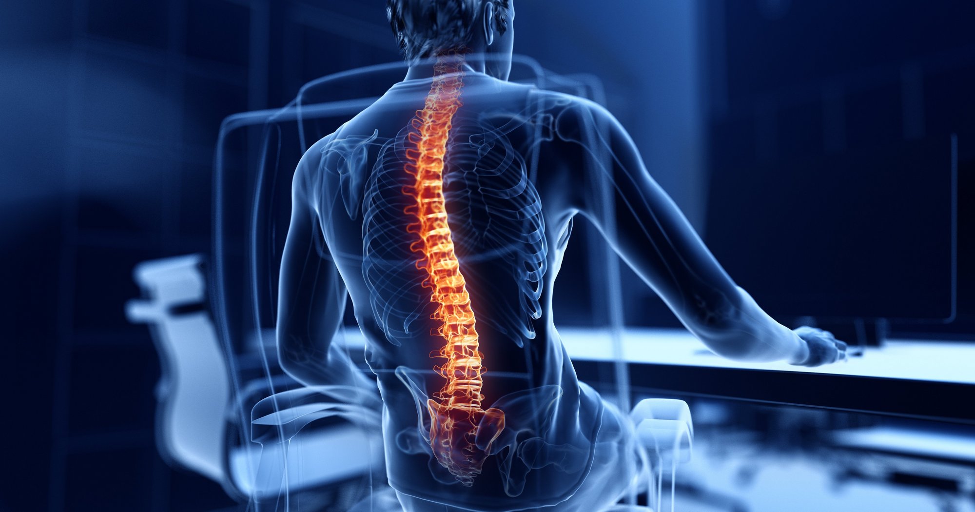 Die Anatomie des Rückens: SRH Klinikum Karlsbad-Langensteinbach